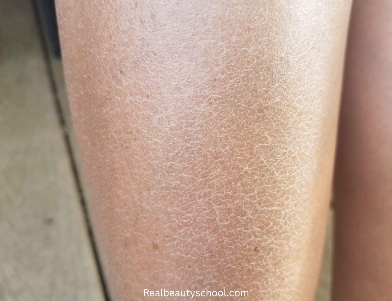 Why You Should Be Using Retinol for the Body (for stretch marks, Rough ...